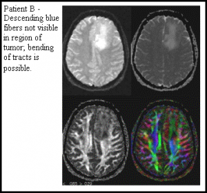 Effective Connectivity – Department of Medical Physics – UW–Madison
